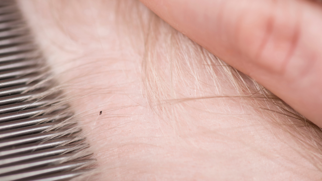 Poux : Comment s’en débarrasser et s’en prémunir ? – Association FEE64