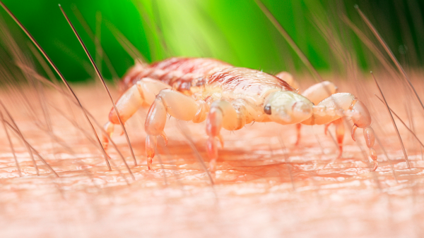 Poux : Comment s’en débarrasser et s’en prémunir ? – Association FEE64